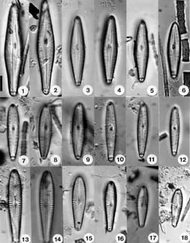California Academy of Sciences - Diatoms